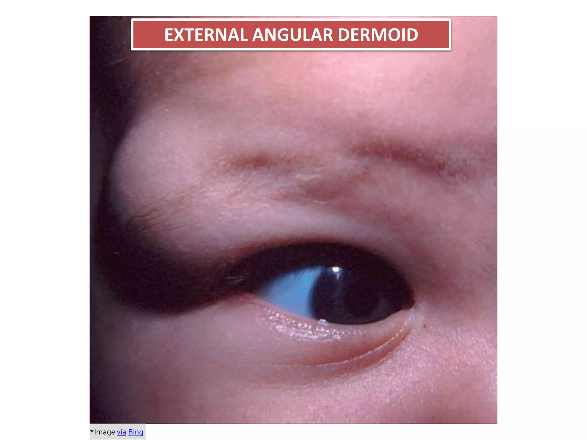 Examination of swelling | PPTX