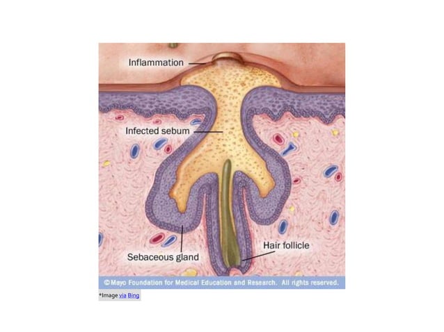 Examination of swelling | PPTX | Blood Disorders | Diseases and Conditions