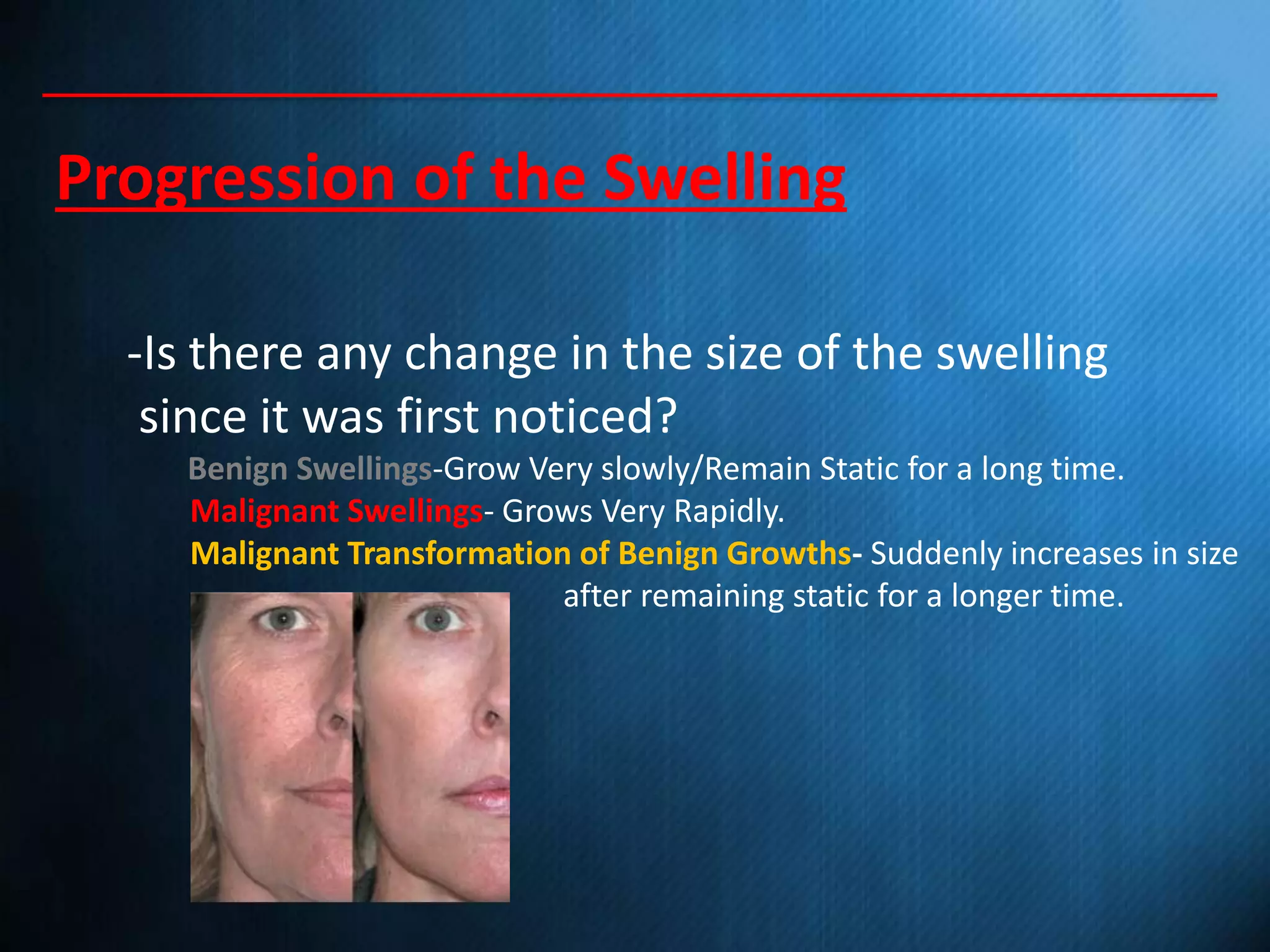Examination of Swelling | PPTX