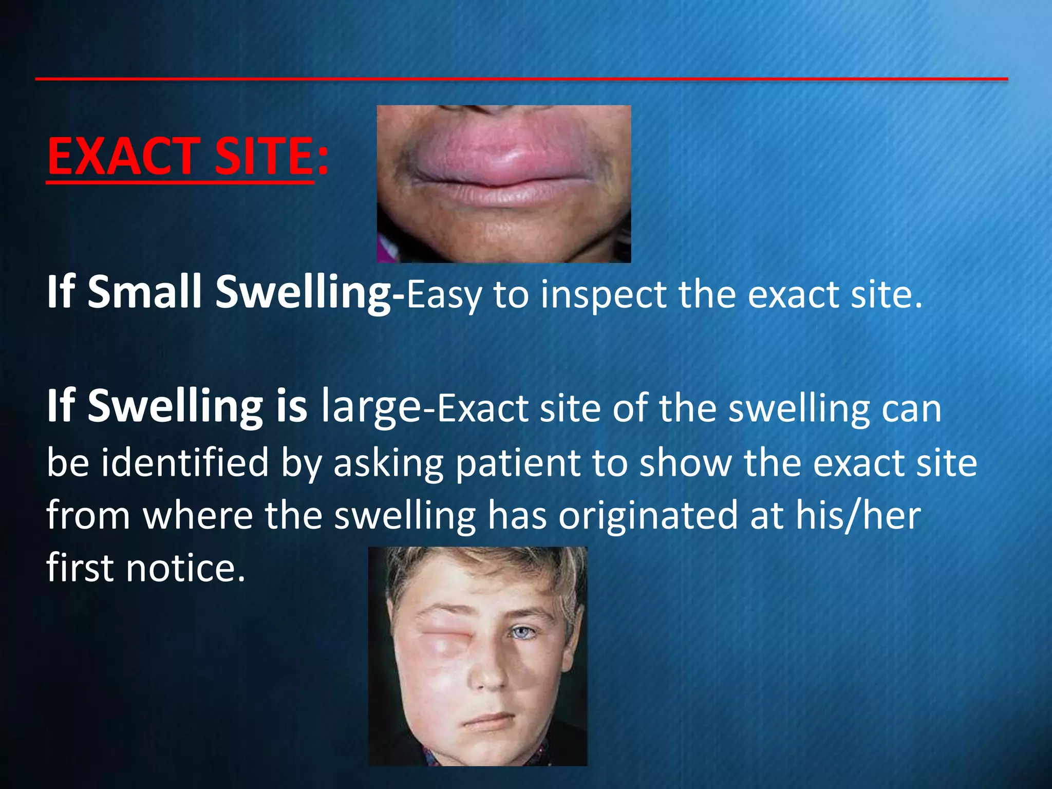 Examination of Swelling | PPTX
