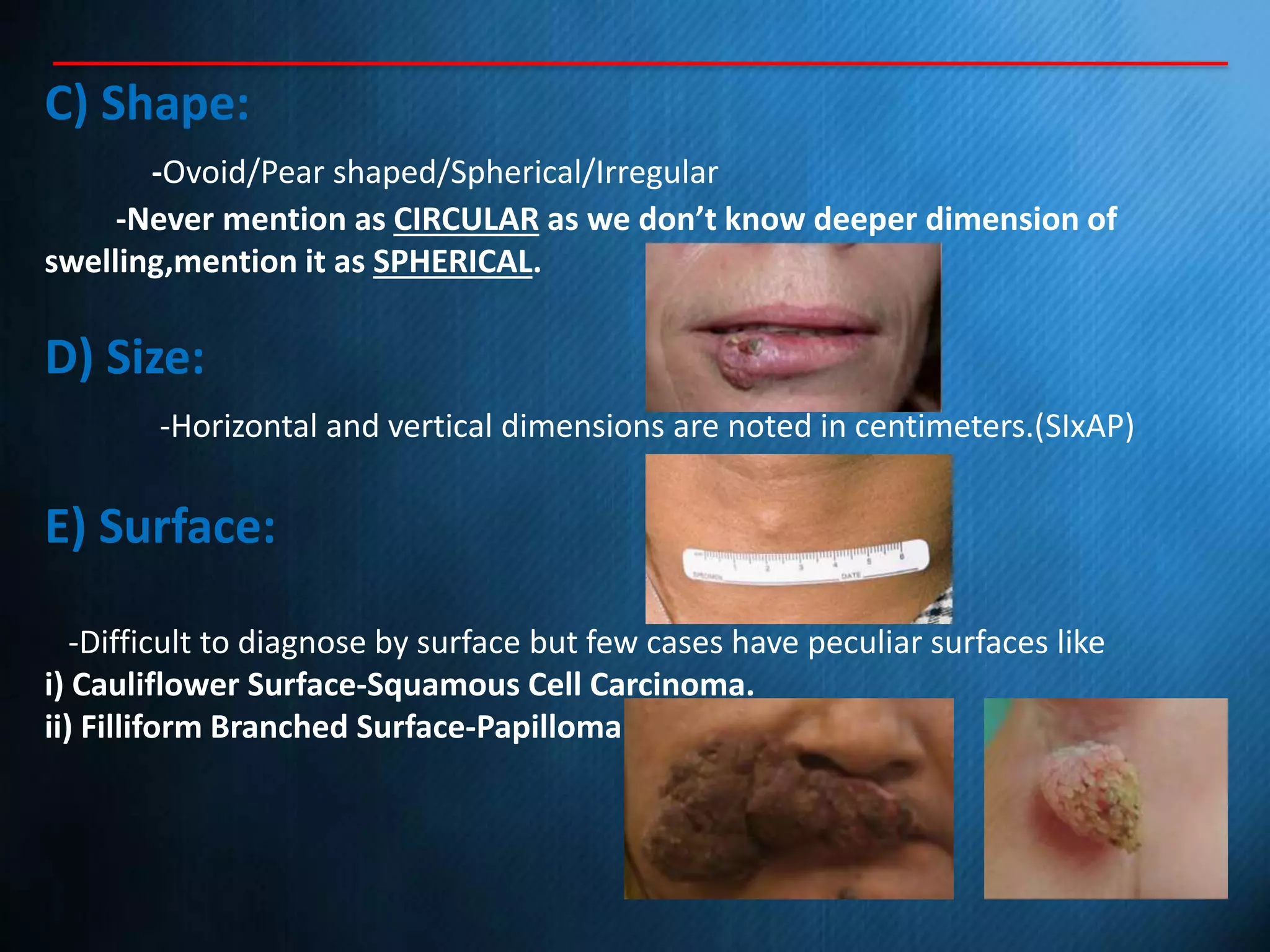 Examination of Swelling | PPTX