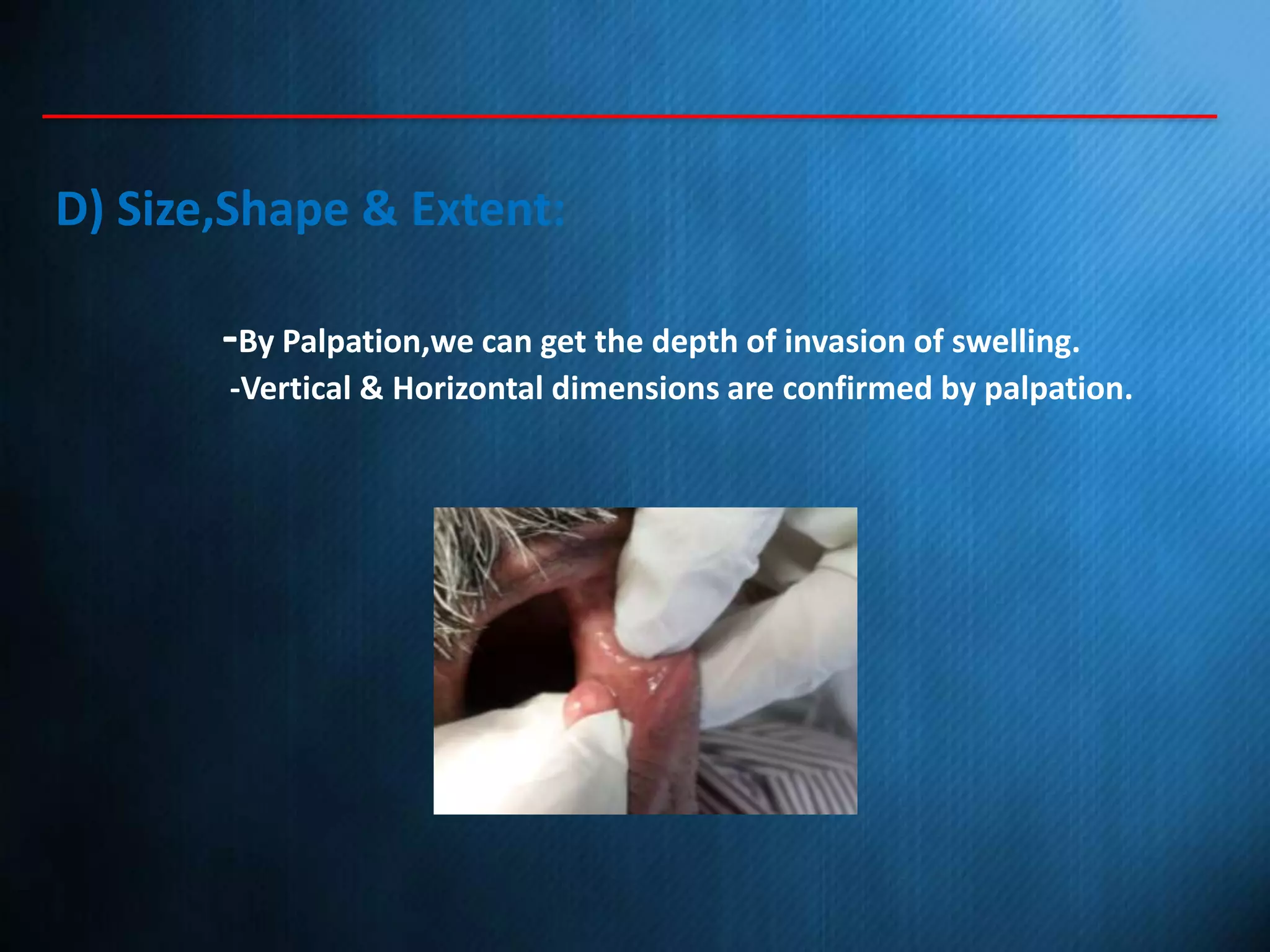 Examination of Swelling | PPTX