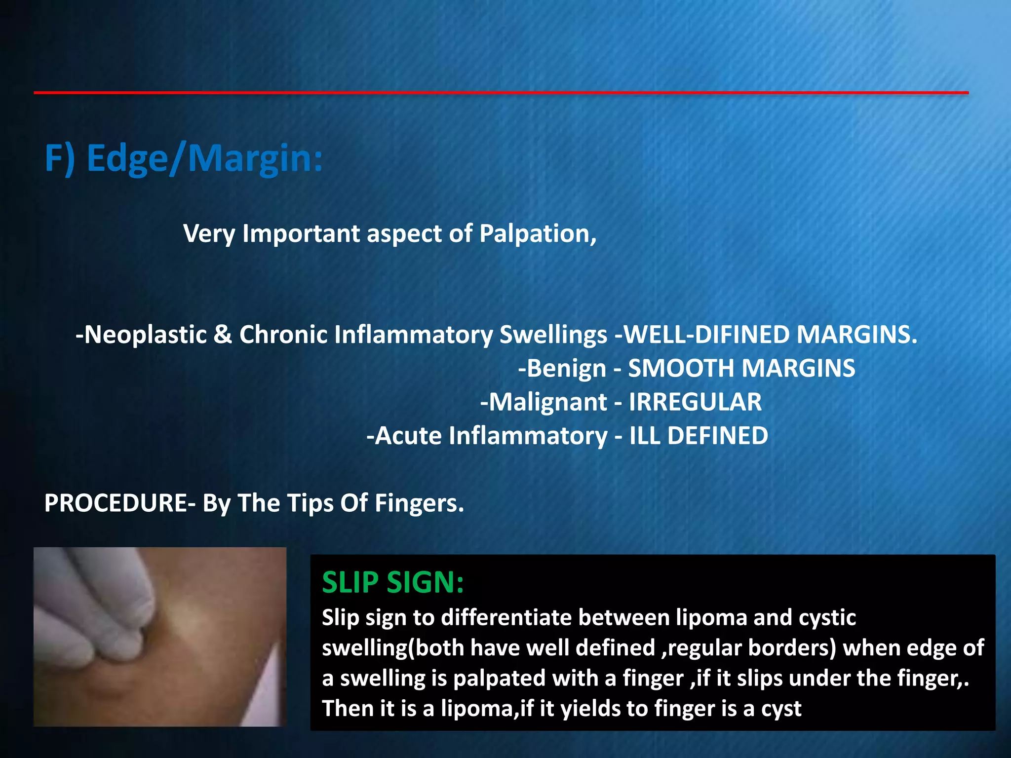 Examination of Swelling | PPTX