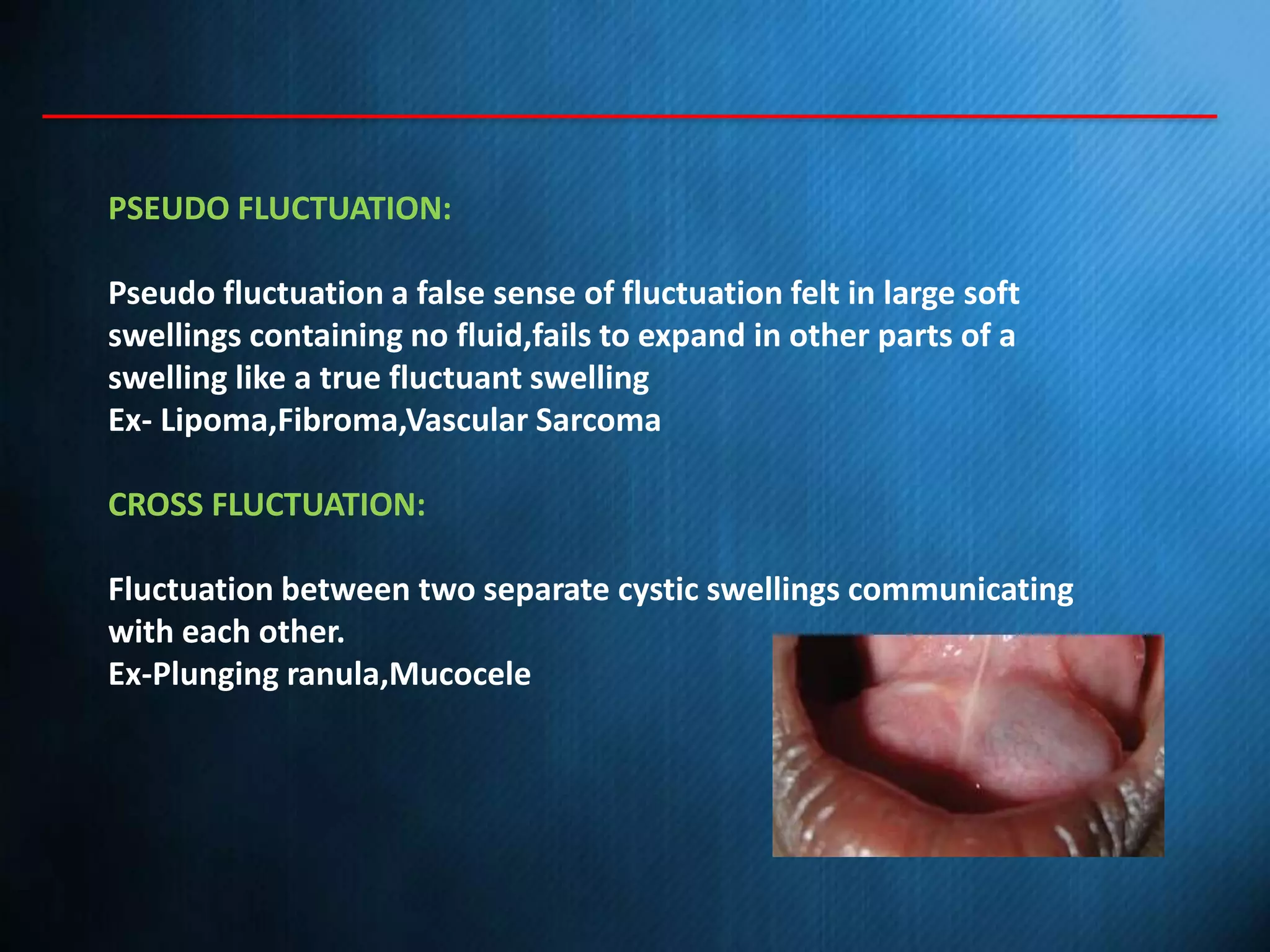 Examination of Swelling | PPTX