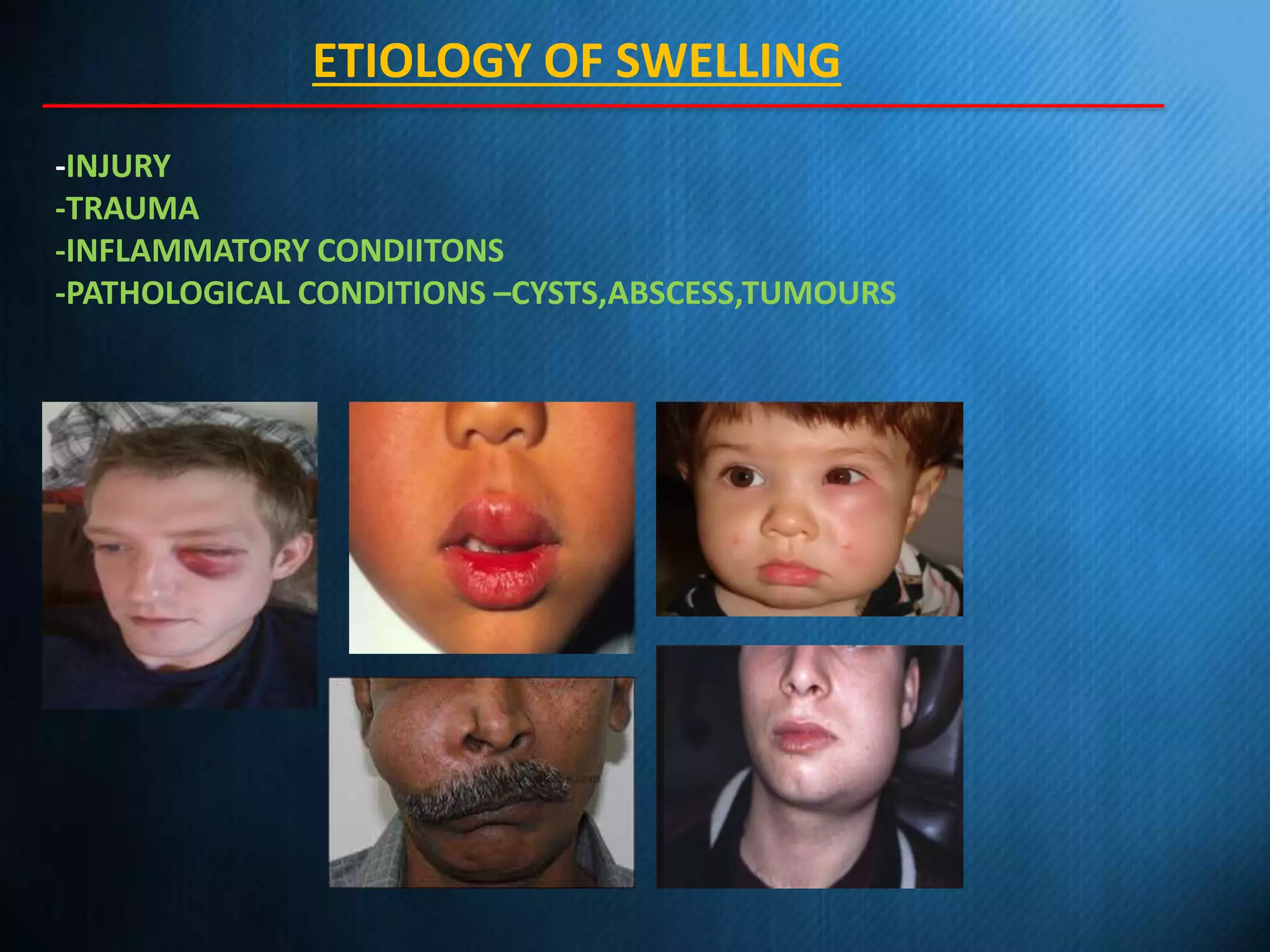 Examination of Swelling | PPTX