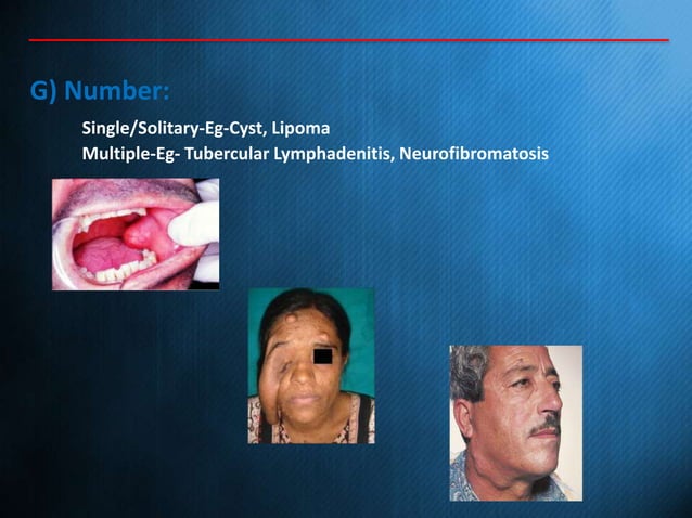 Examination of Swelling | PPTX