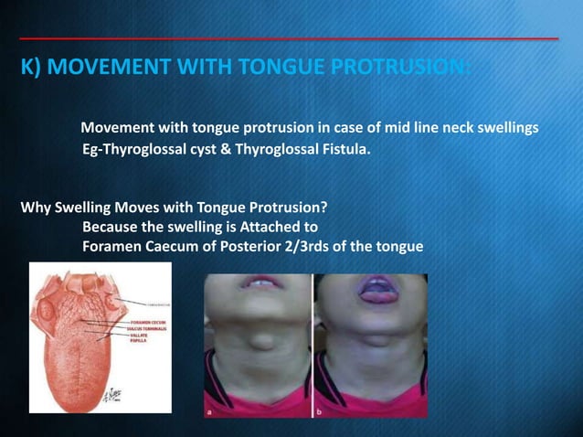 Examination of Swelling | PPTX