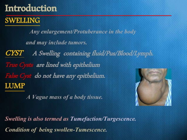 Examination of Swelling | PPTX