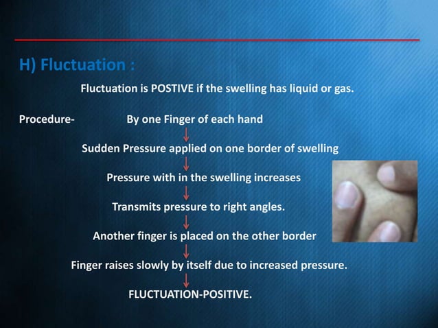 Examination of Swelling | PPTX