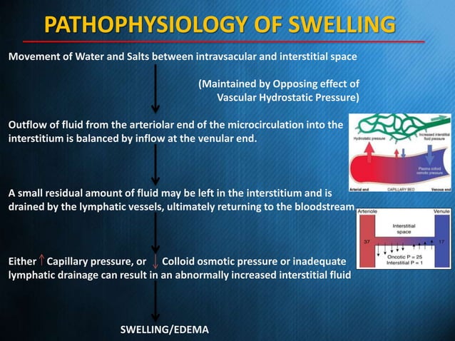 Examination of Swelling | PPTX