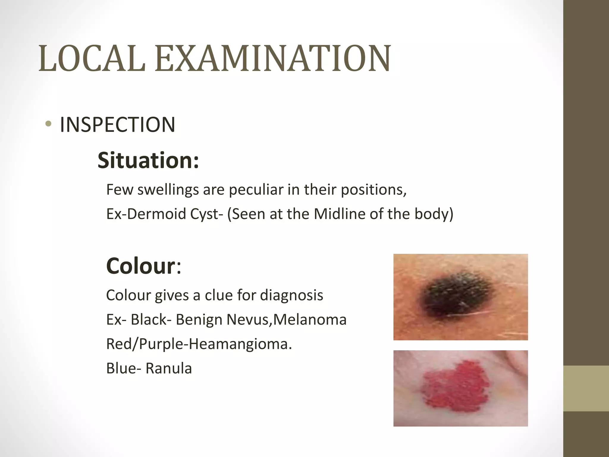 Examination of swelling | PPTX