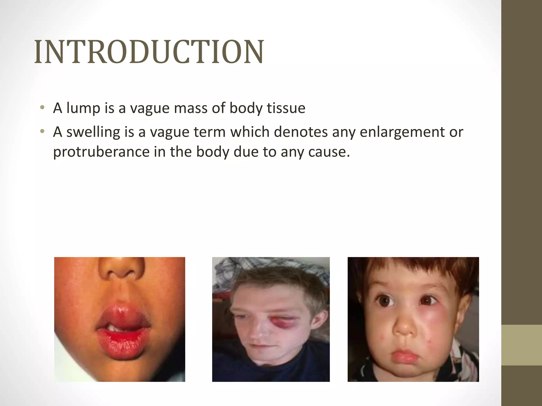 Examination of swelling | PPTX