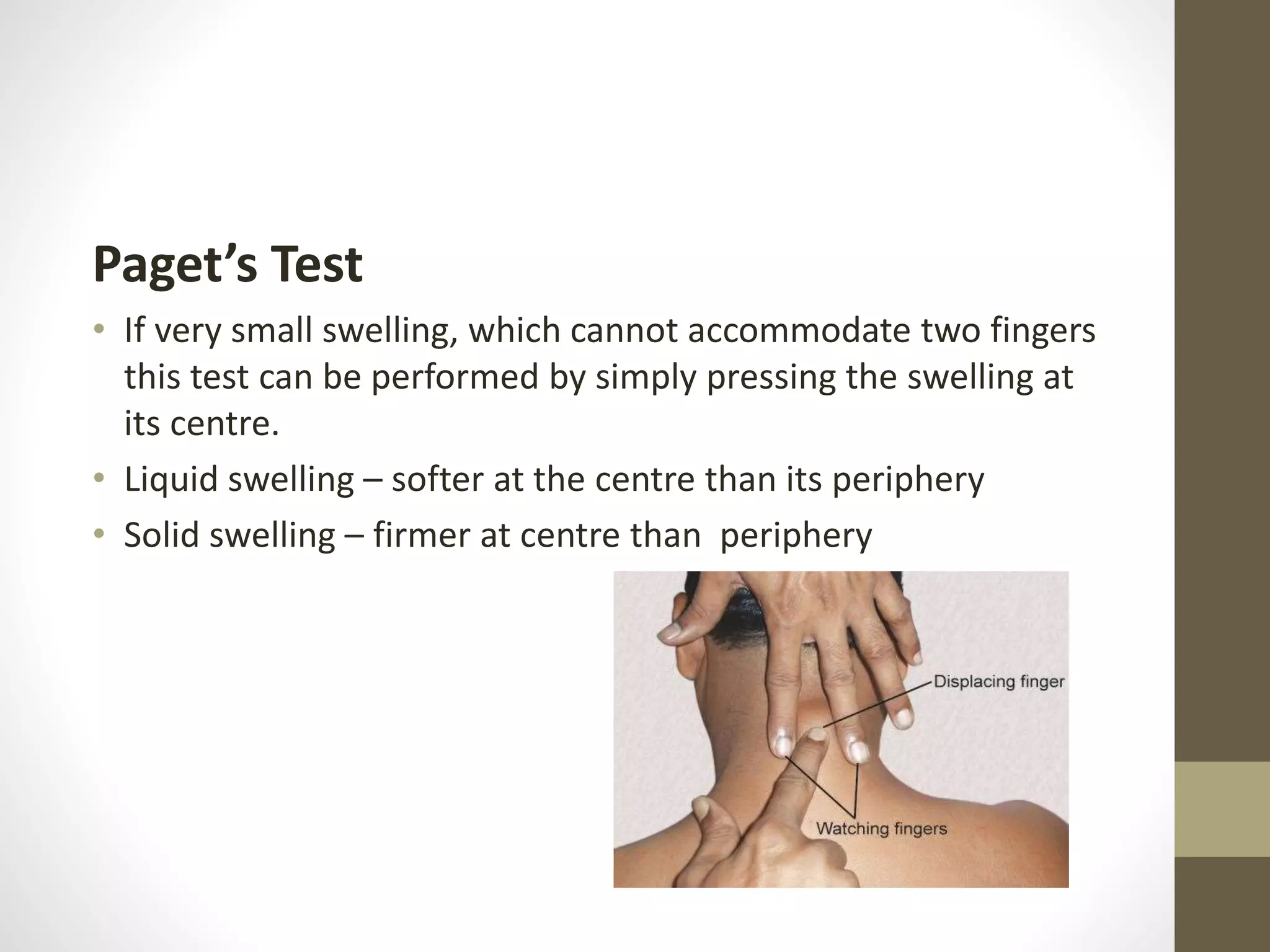 Examination of swelling | PPTX