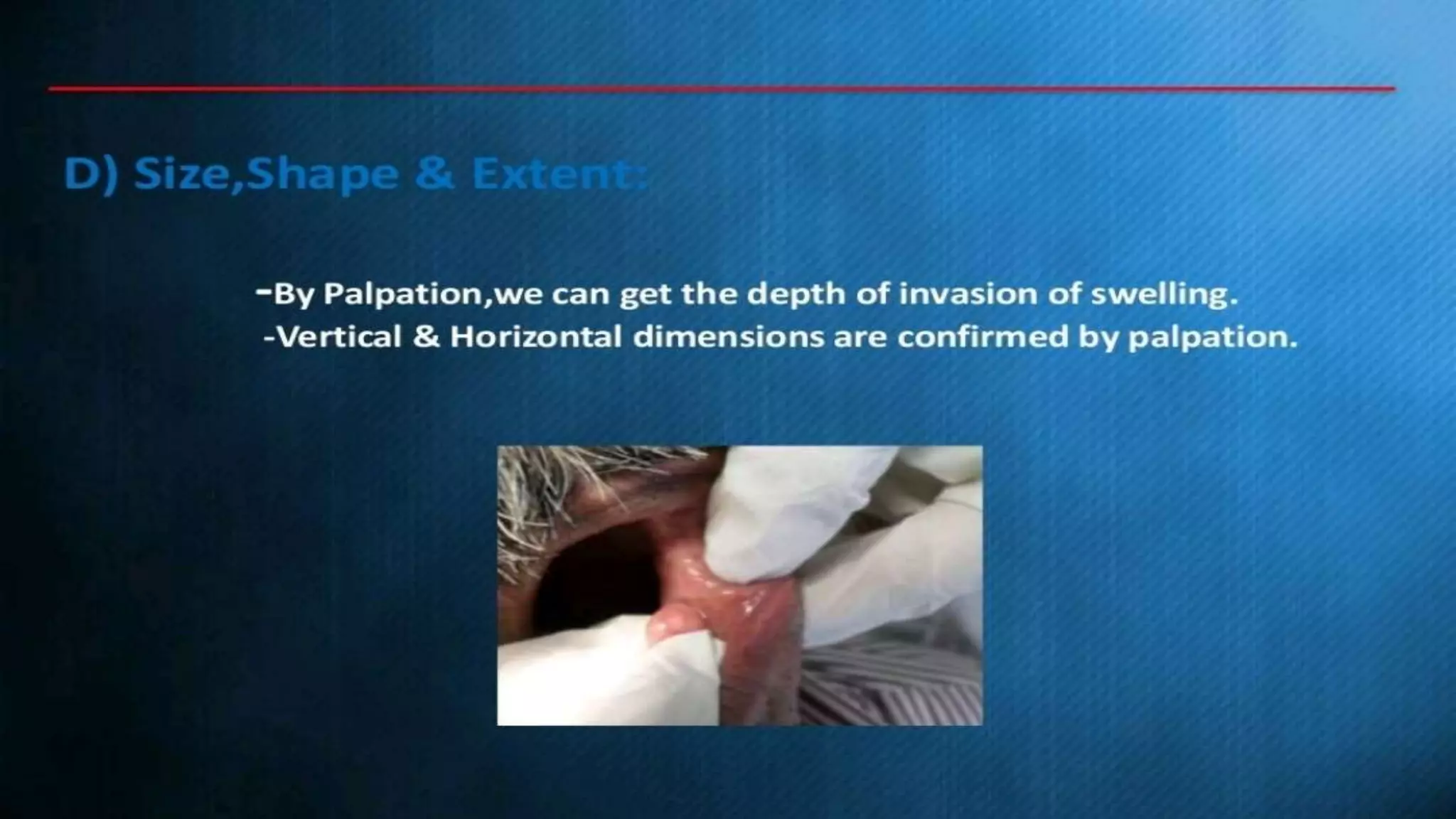 Examination Of Swelling $.pptx