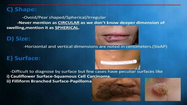 Examination Of Swelling $.pptx