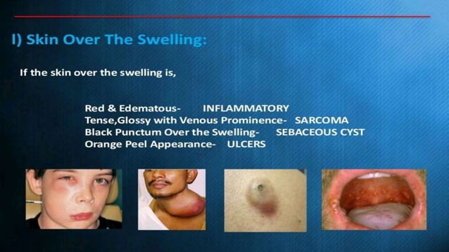Examination Of Swelling $.pptx
