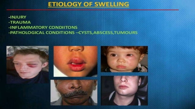 Examination Of Swelling $.pptx