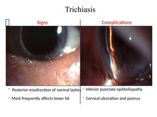 EXAMINATION OF THE ANTERIOR SEGMENT.pptx