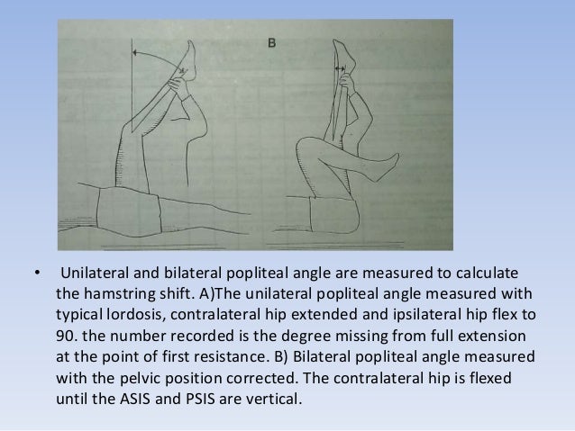 Examination of the child with cerebral palsy