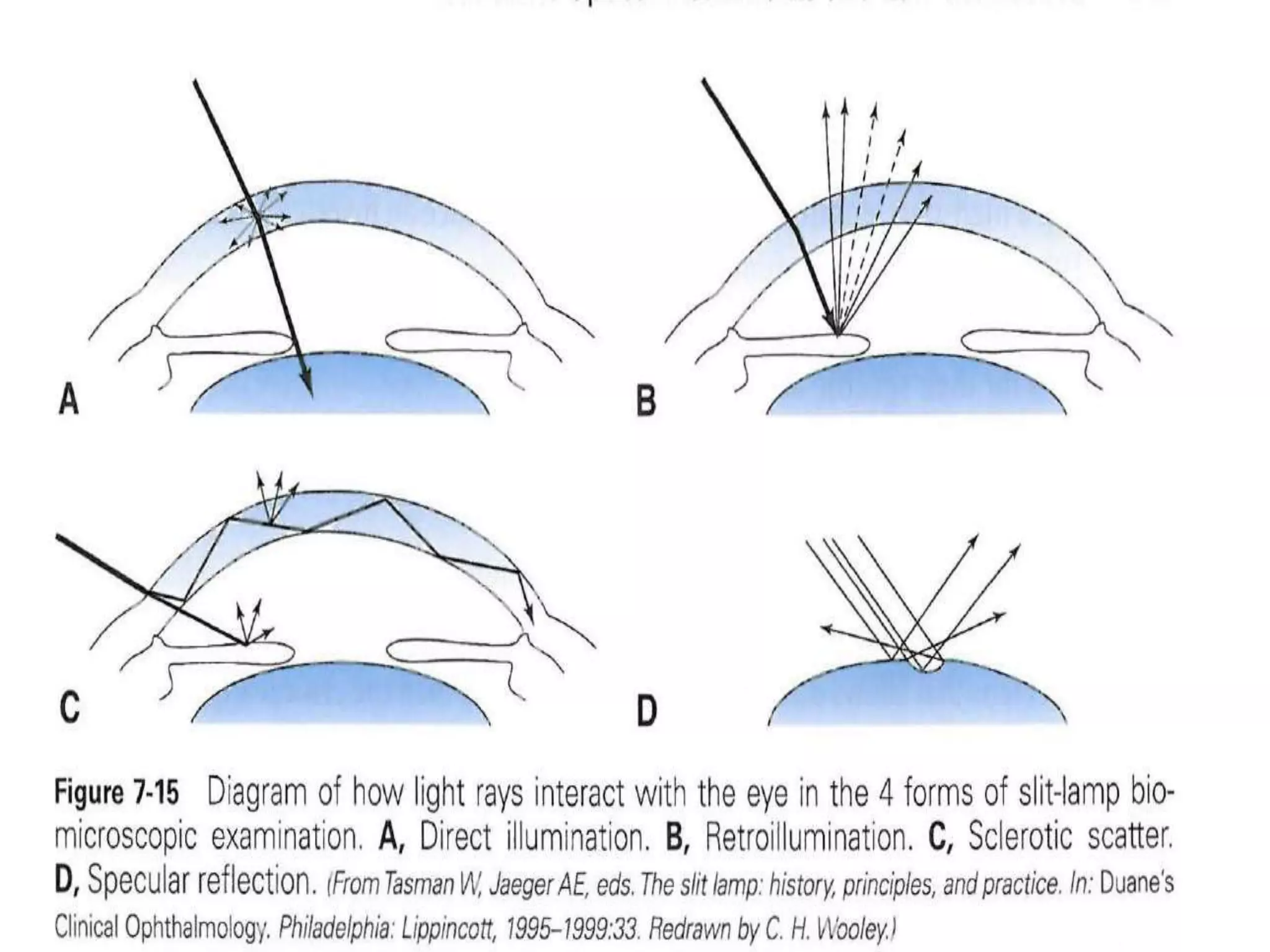 Examination of the cornea by Dr. Iddi Ndyabawe | PPTX