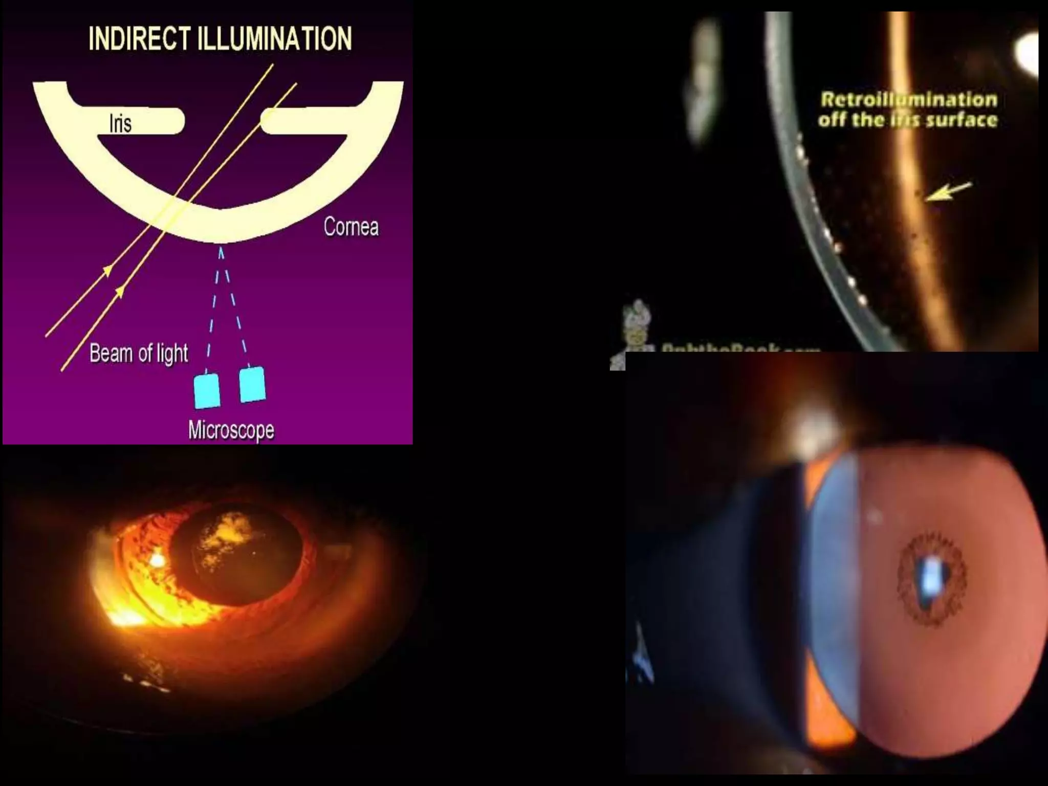 Examination of the cornea by Dr. Iddi Ndyabawe | PPTX