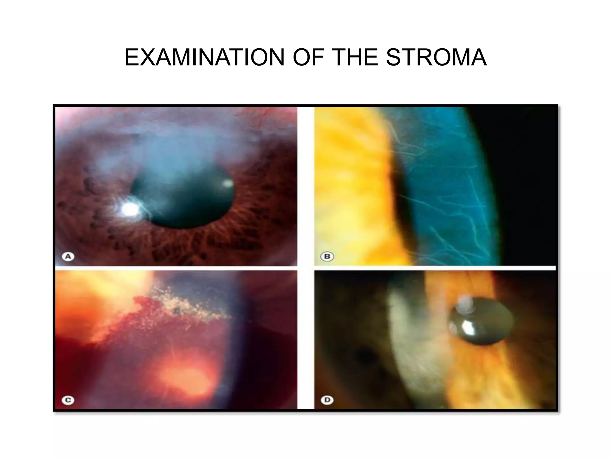 Examination of the cornea by Dr. Iddi Ndyabawe | PPTX