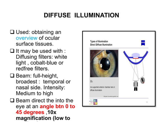 Examination of the cornea by Dr. Iddi Ndyabawe | PPTX