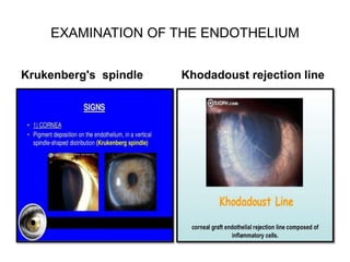 Examination of the cornea by Dr. Iddi Ndyabawe | PPTX