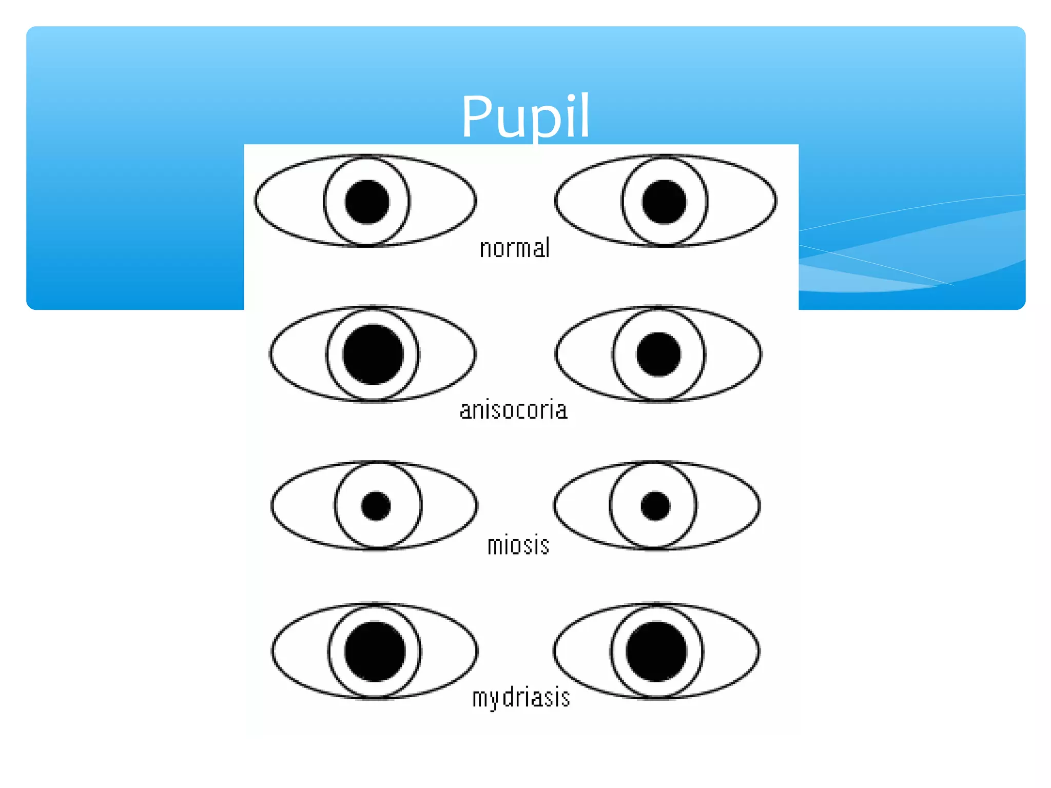 Cinical examination of the eye | PPT