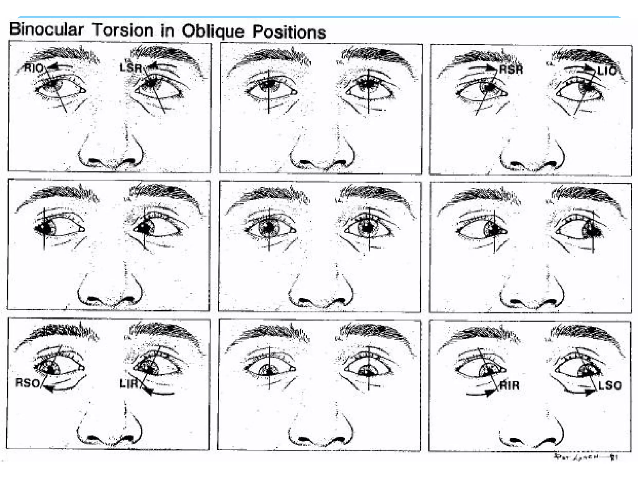 Cinical examination of the eye | PPT