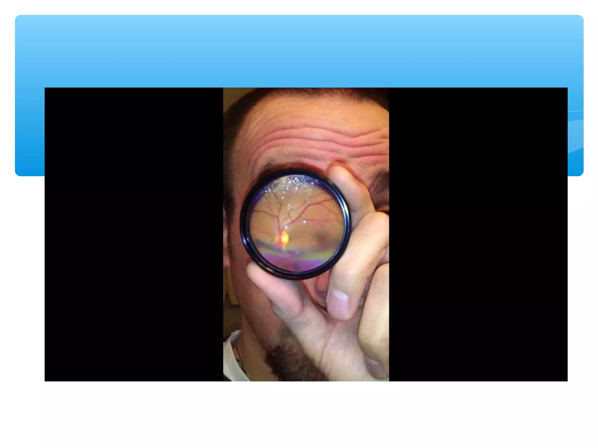 Cinical examination of the eye | PPT