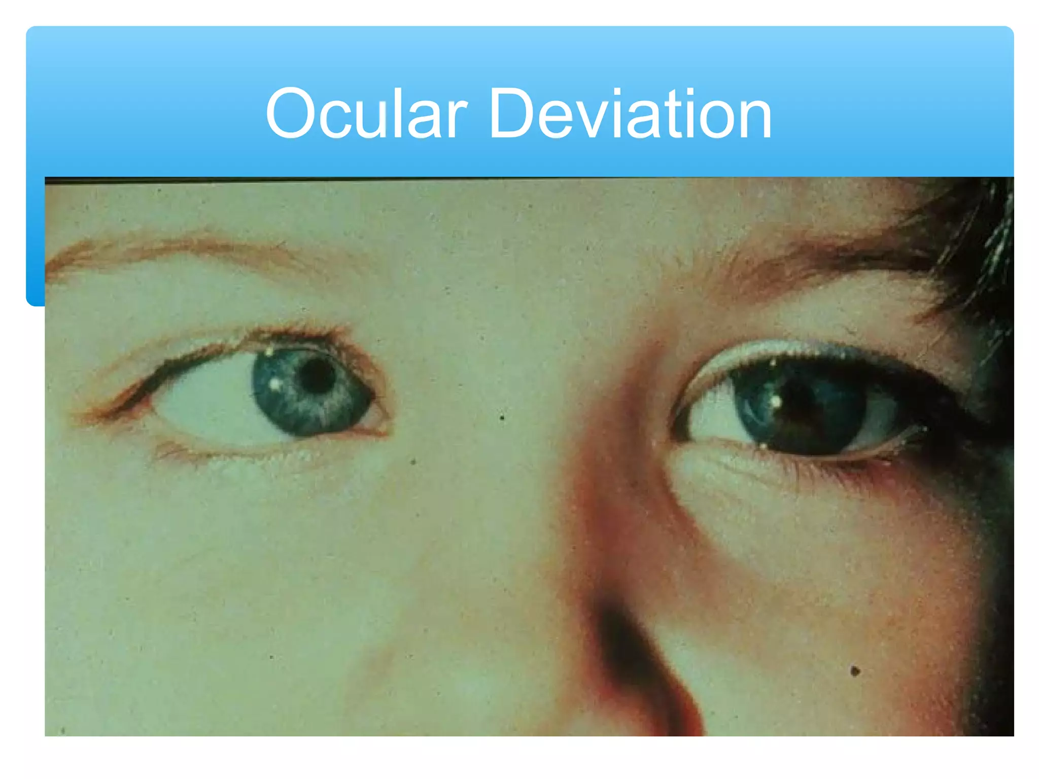 Cinical examination of the eye | PPT