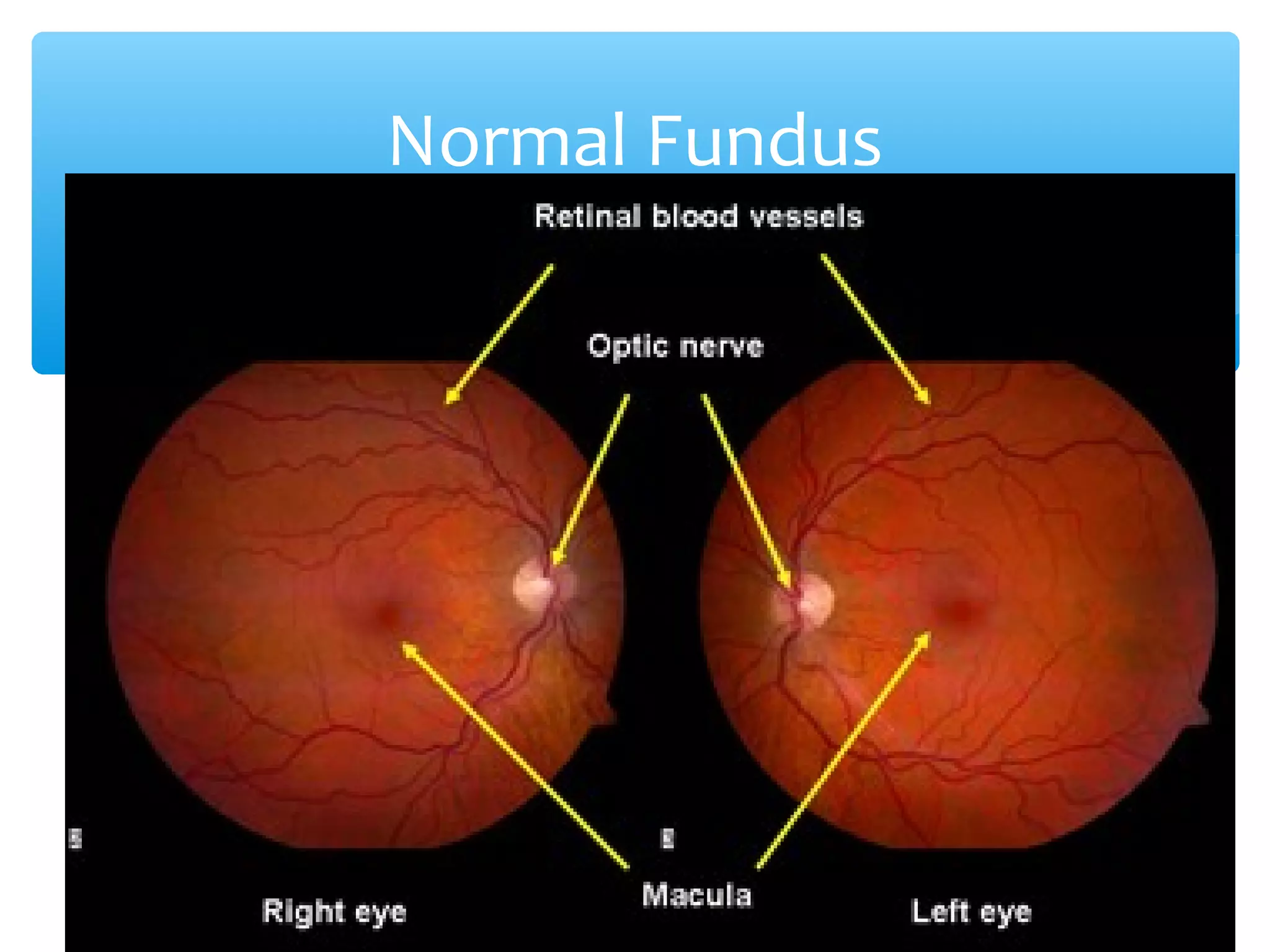 Cinical examination of the eye | PPT