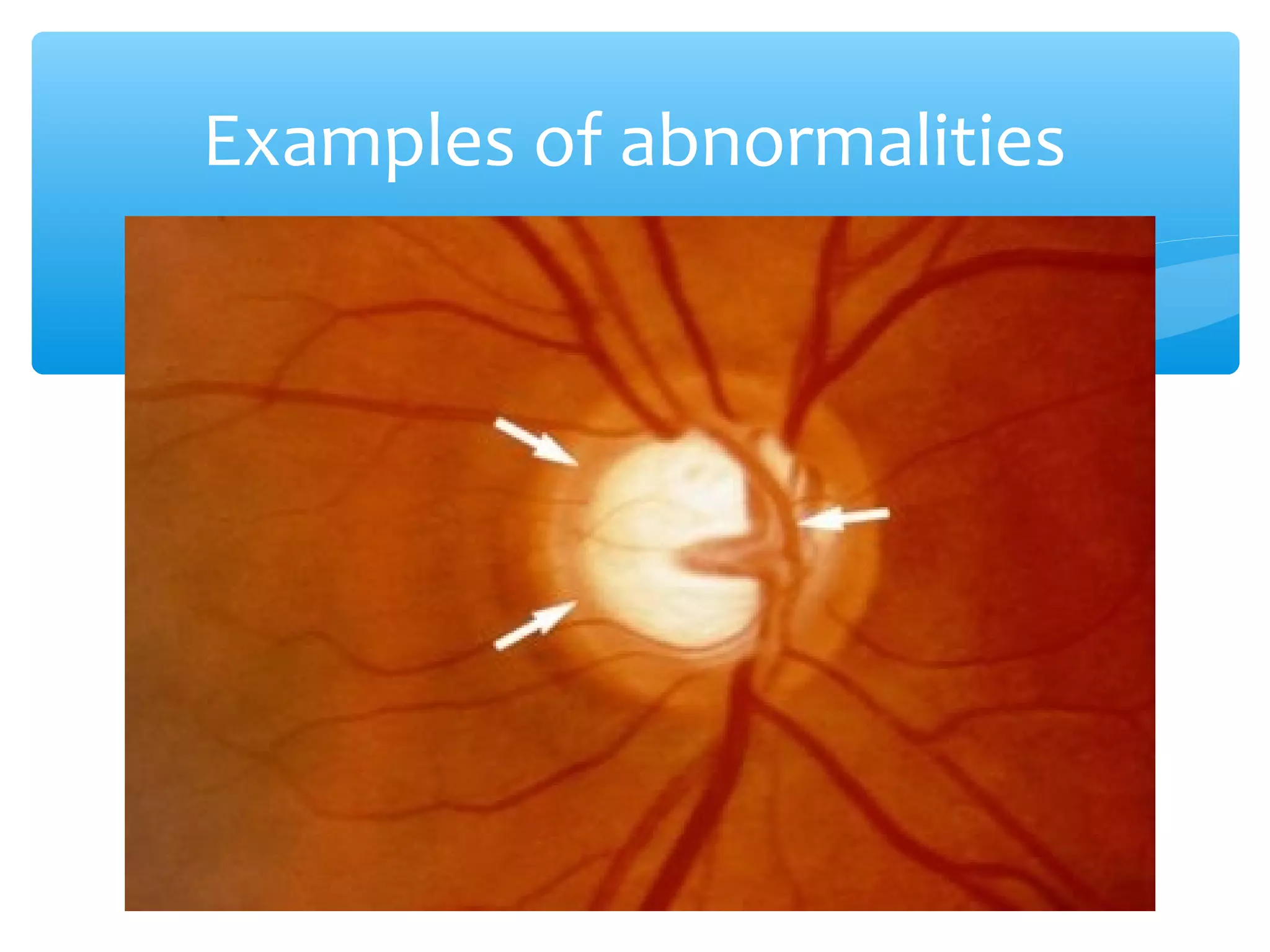 Cinical examination of the eye | PPT