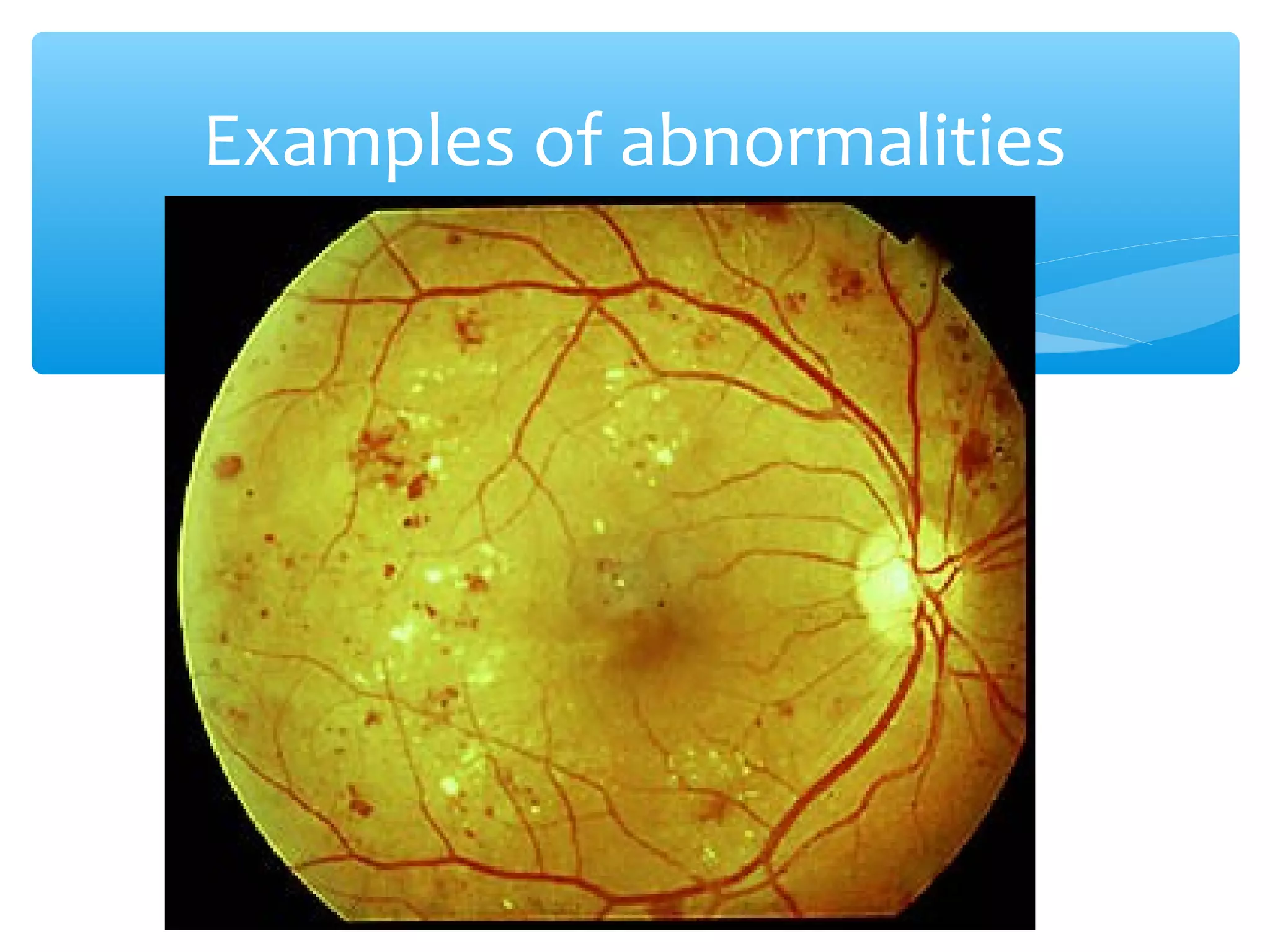 Cinical examination of the eye | PPT
