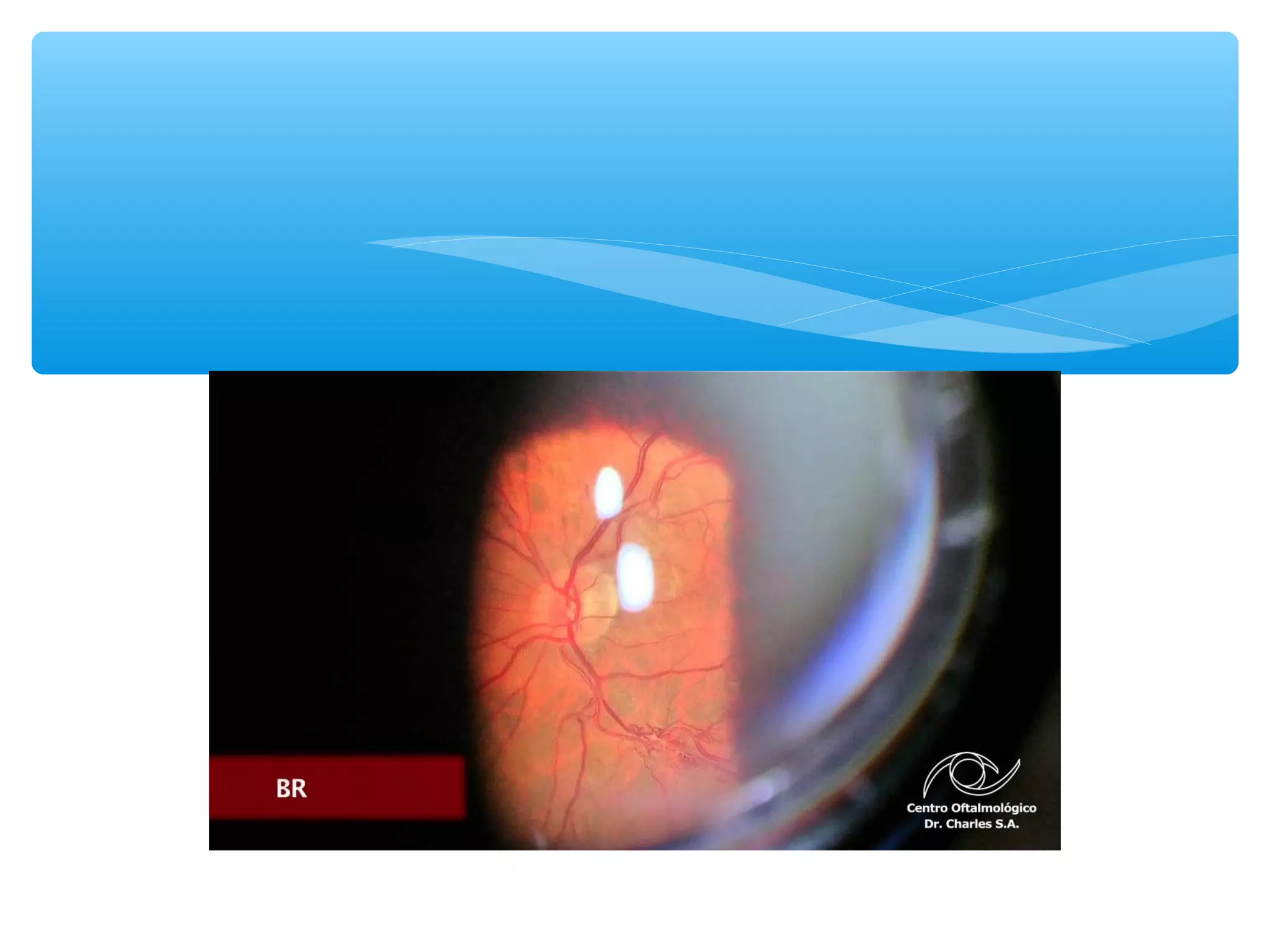 Cinical examination of the eye | PPT