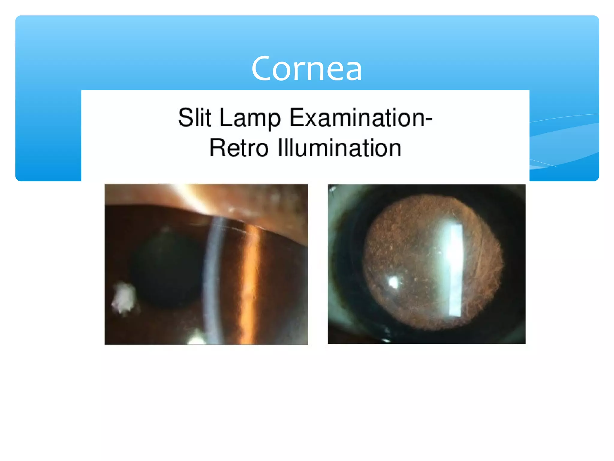 Cinical examination of the eye | PPT