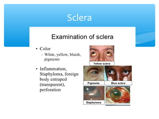 Cinical examination of the eye | PPT