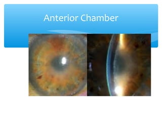 Cinical examination of the eye | PPT