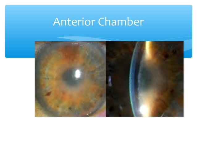 Cinical examination of the eye | PPT