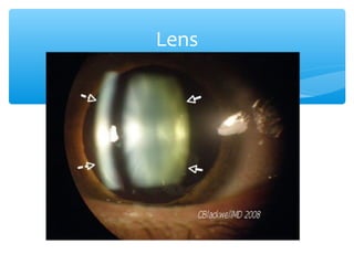 Cinical examination of the eye | PPT