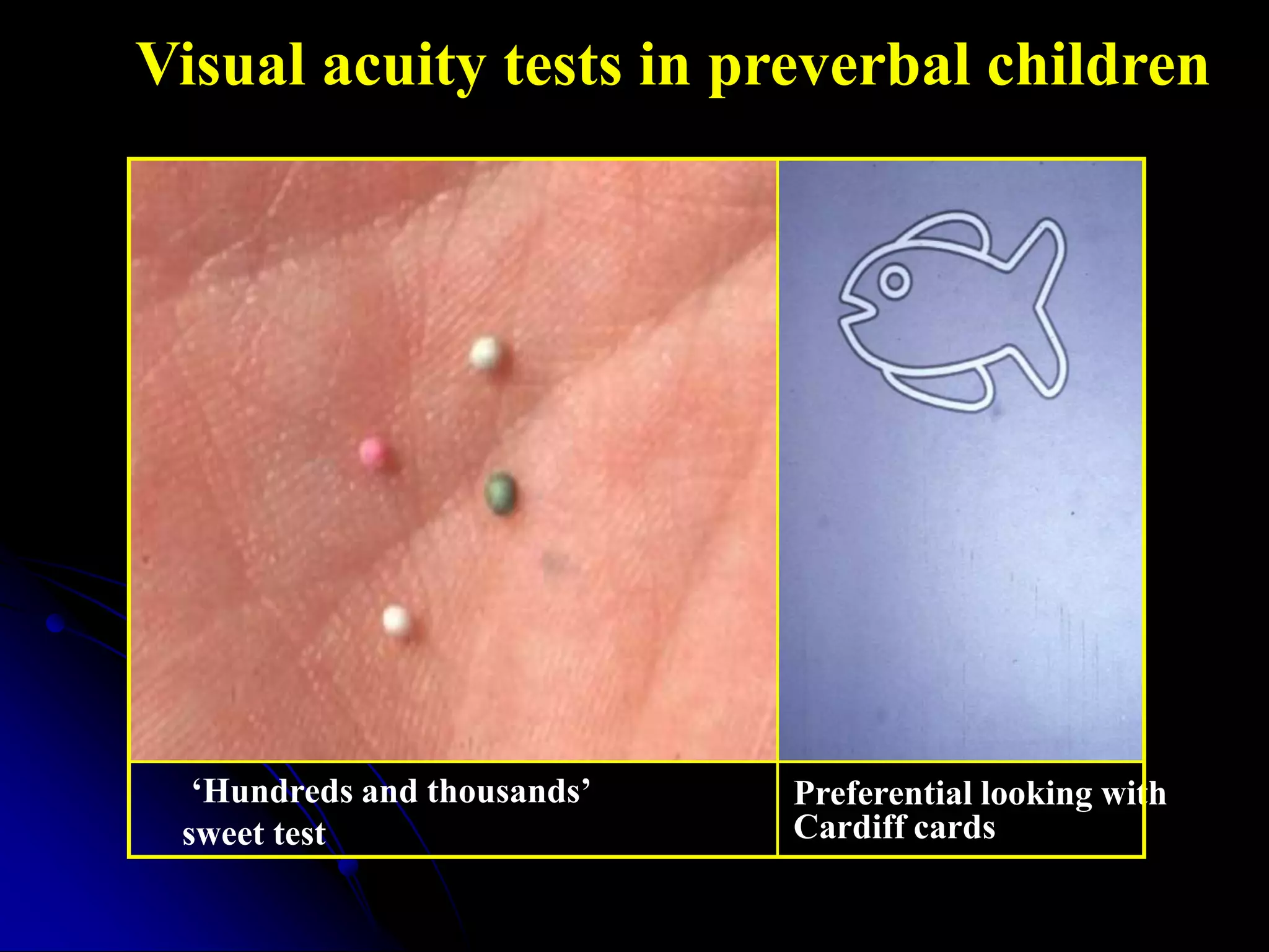 Examination of the eye | PPT