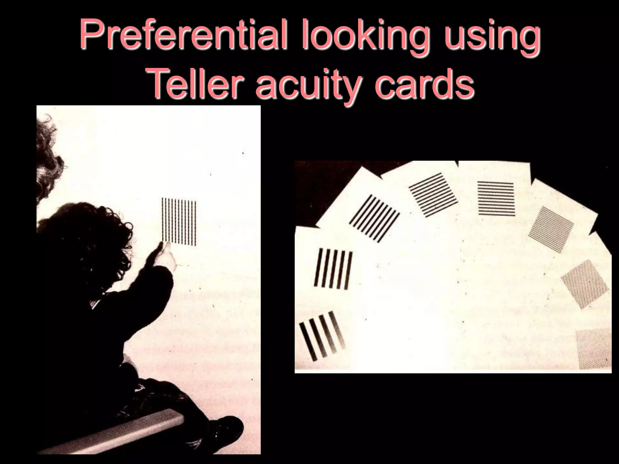 Examination of the eye | PPT