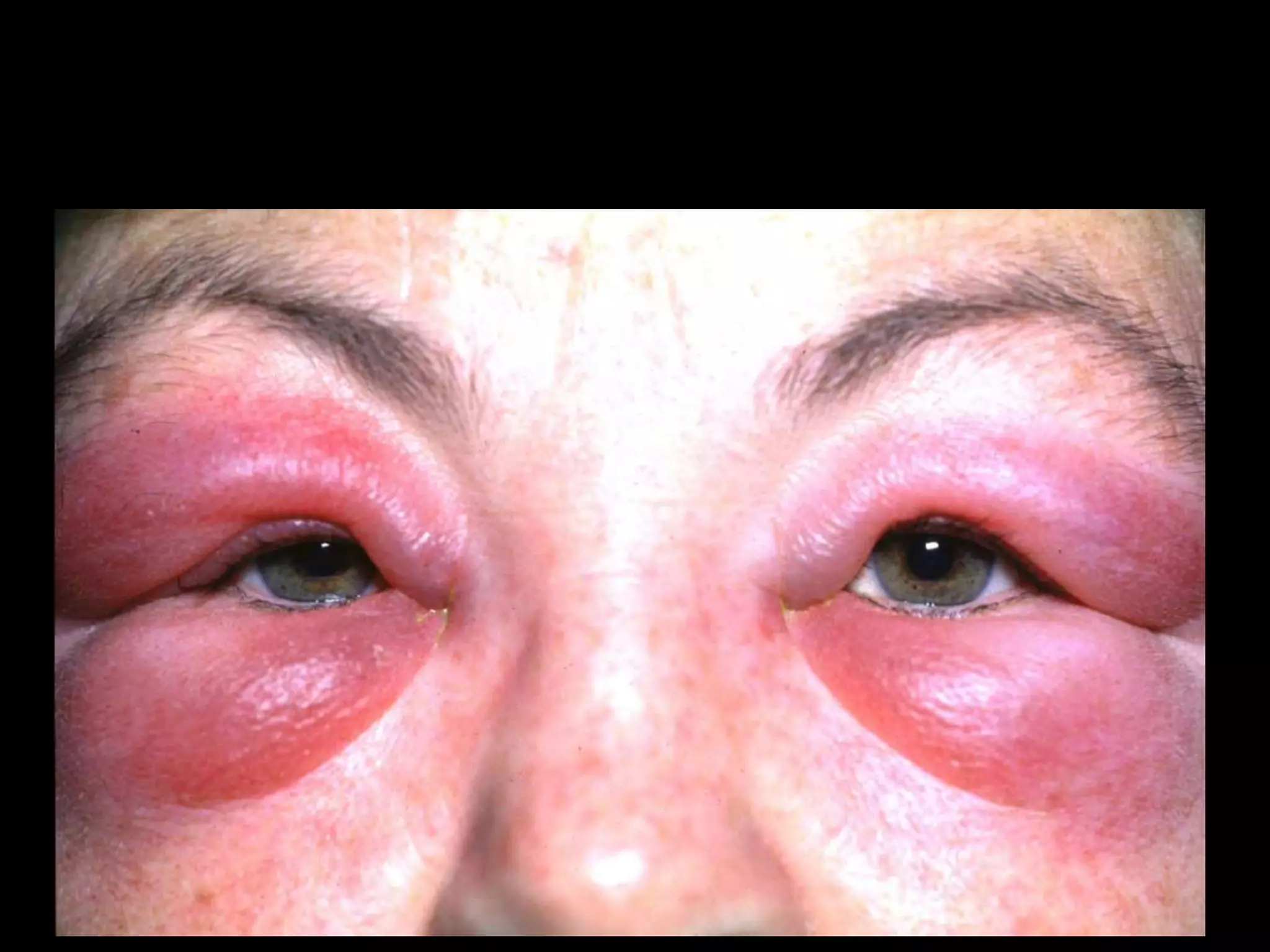 Examination of the eye | PPT