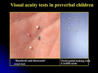 Examination of the eye | PPT