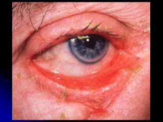 Examination of the eye | PPT