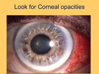 Examination of the eye | PPT
