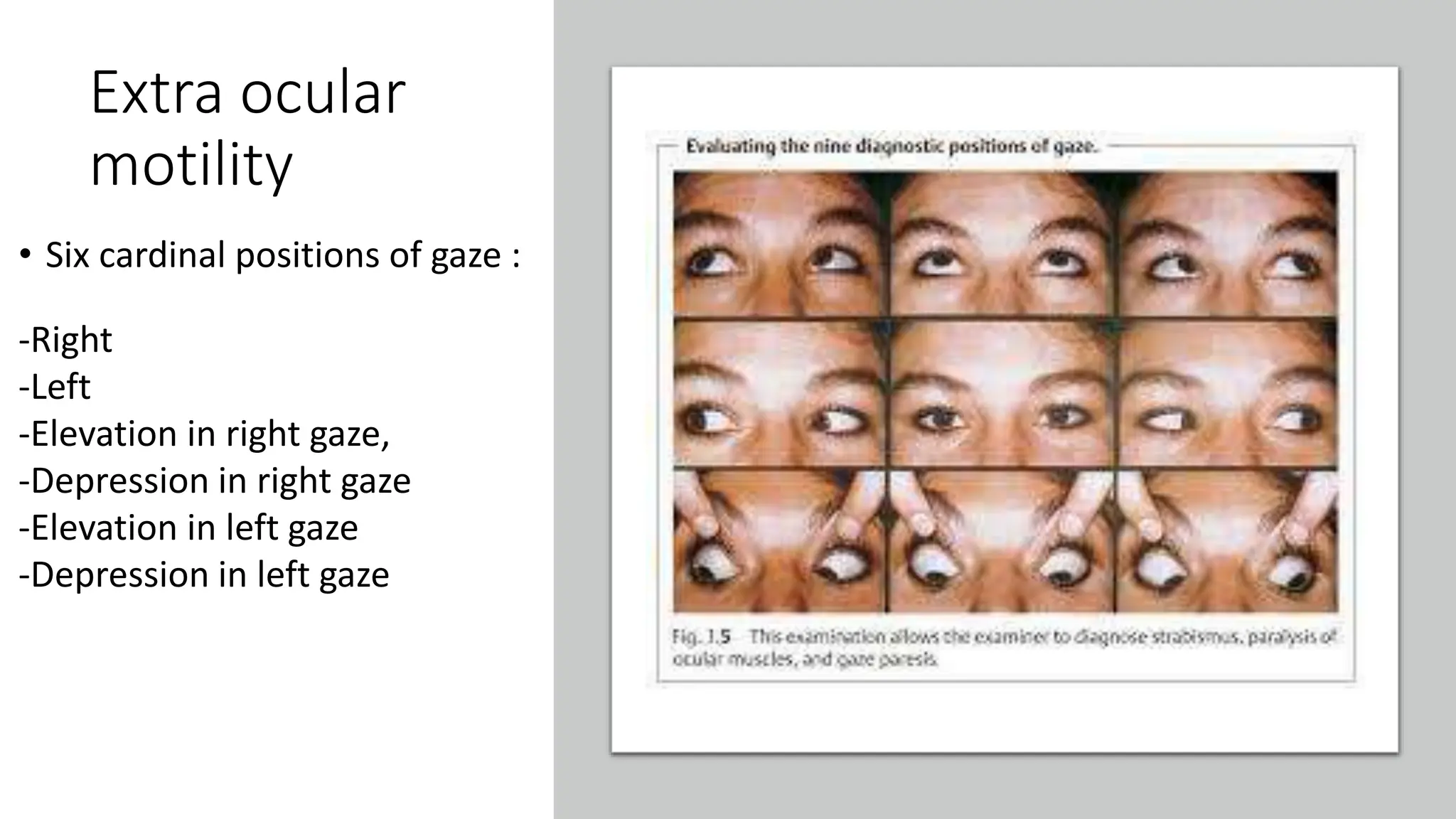 EXAMINATION OF THE EYE.pptx