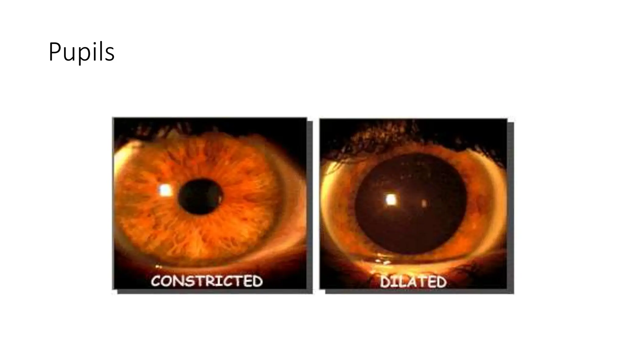 EXAMINATION OF THE EYE.pptx