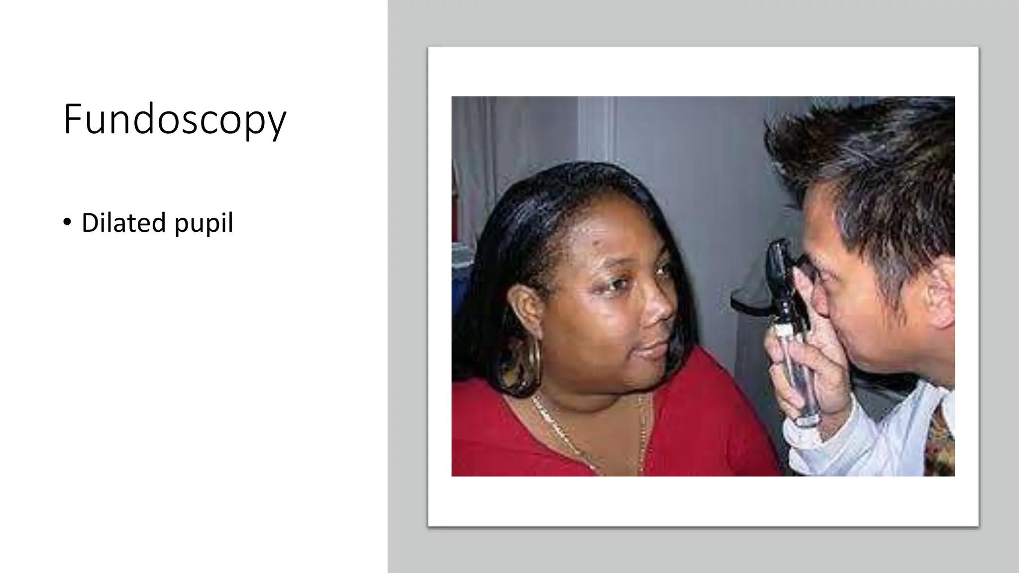 EXAMINATION OF THE EYE.pptx